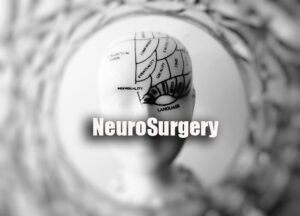 Neurosurgery Questions and Answers | Objective Question Bank