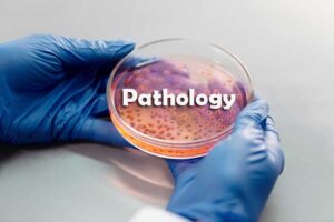 Pathology MCQ | Objective Type Papers for Medical Students